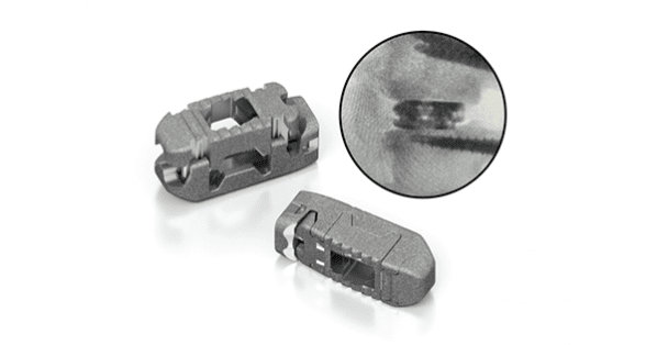 First Cases with Life Spine TRULIFT Expandable Spacer | ORTHOWORLD