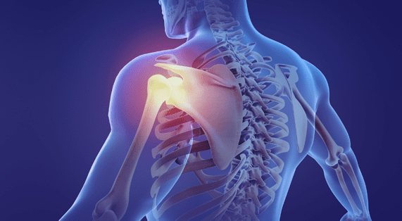 Studies Suggest CSR Shoulder Outperforms Stemmed Implants