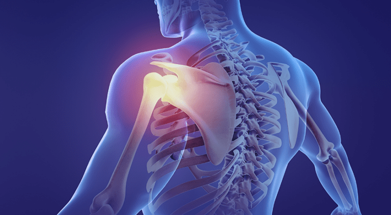 Studies Suggest CSR Shoulder Outperforms Stemmed Implants