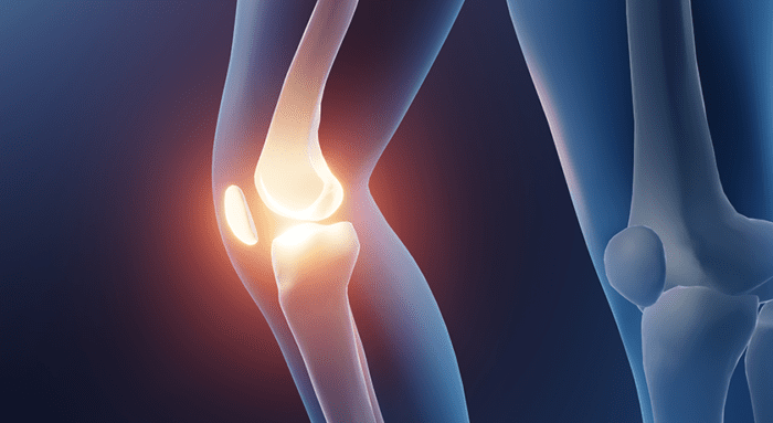 Orthopedic Market Projected to Grow 3.4% in 2022