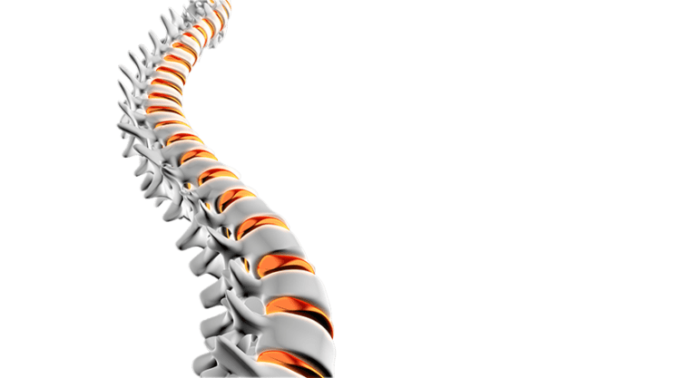 100th Case with Surgalign Cortera Spinal Fixation