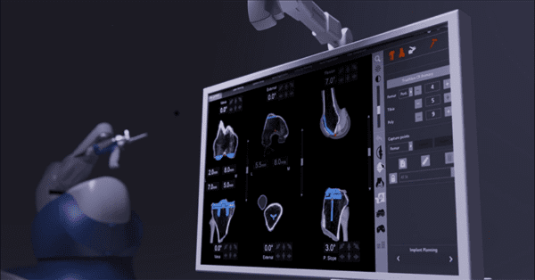 Stryker Debuts Mako Total Knee 2.0 | ORTHOWORLD
