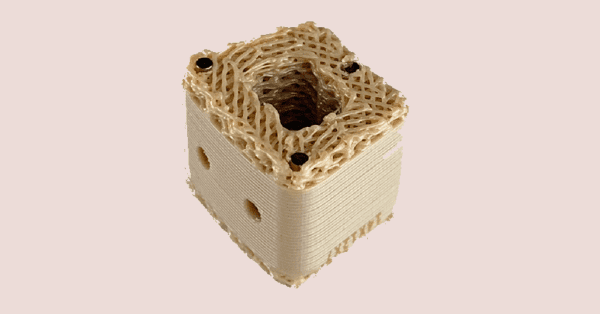 First Case with Curiteva Inspire Porous PEEK Cervical Interbody