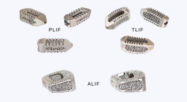Eminent Spine Gains 510(k) for Titanium Lumbar Interbody Fusion