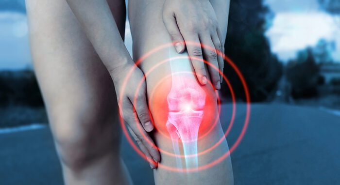 Artelon Gains FDA Clearance for Ligament Reinforcements Artelon Gains FDA Clearance for Ligament Reinforcements