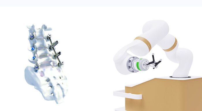 Spine Wave Partners With Ecential Robotics Orthoworld