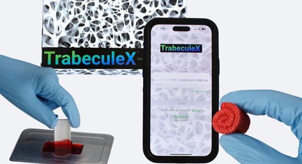 Xenco Medical Unveils the TrabeculeX Continuum | ORTHOWORLD Xenco Medical Unveils the TrabeculeX Continuum | ORTHOWORLD