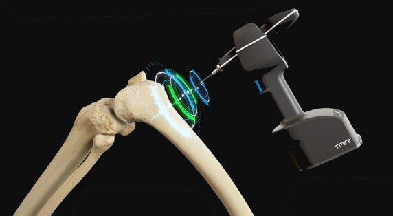 THINK Surgical Granted 510(k) for TMINI Miniature Robotic System