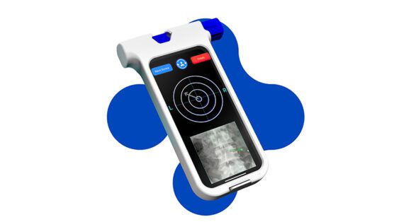 Bolt Navigation Announces Spine Navigation Platform 2.0 Release ...