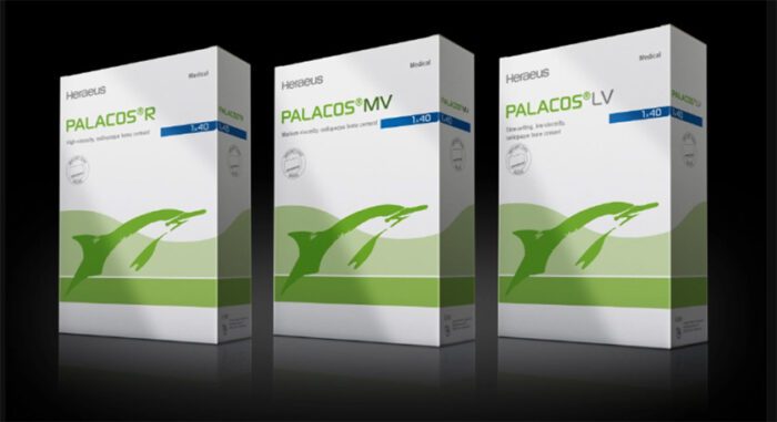 PALACOS Bone Cements Prove Effective in Knee Arthroplasty | ORTHOWORLD