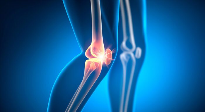 Largest Knee Replacement Players Facing Market Share Erosion | ORTHOWORLD