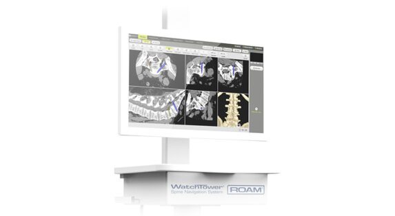 Captiva Spine Gains 510(k) for Navigation Components
