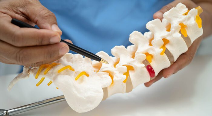DePuy Synthes Launches VELYS SPINE | ORTHOWORLD