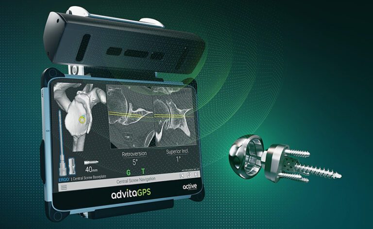 MatOrtho Gains CE Mark for ReCerf Hip Resurfacing | ORTHOWORLD
